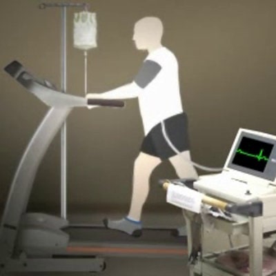 Athletes and heart disease