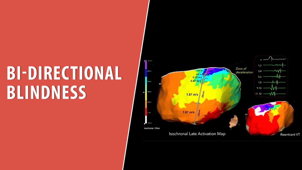 Bi-Directional Blindness