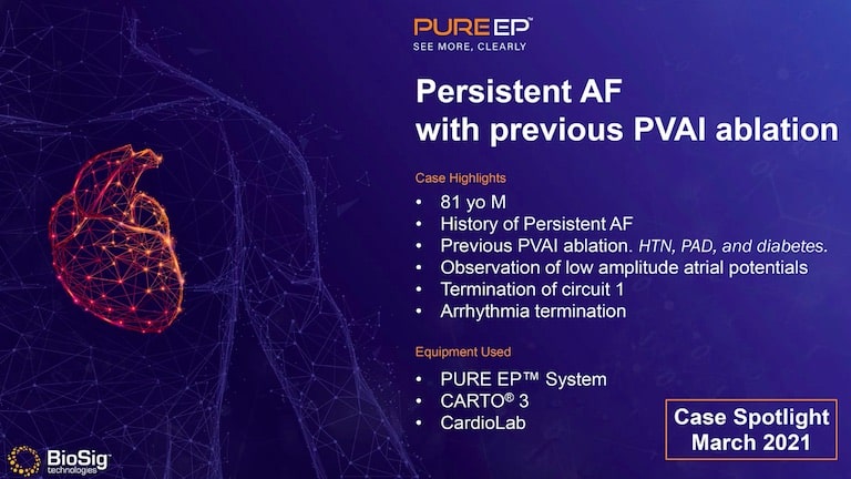 PURE EP™ Case Study: Persistent AF With Previous PVAI Ablation