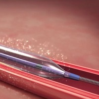 JetStream atherectomy