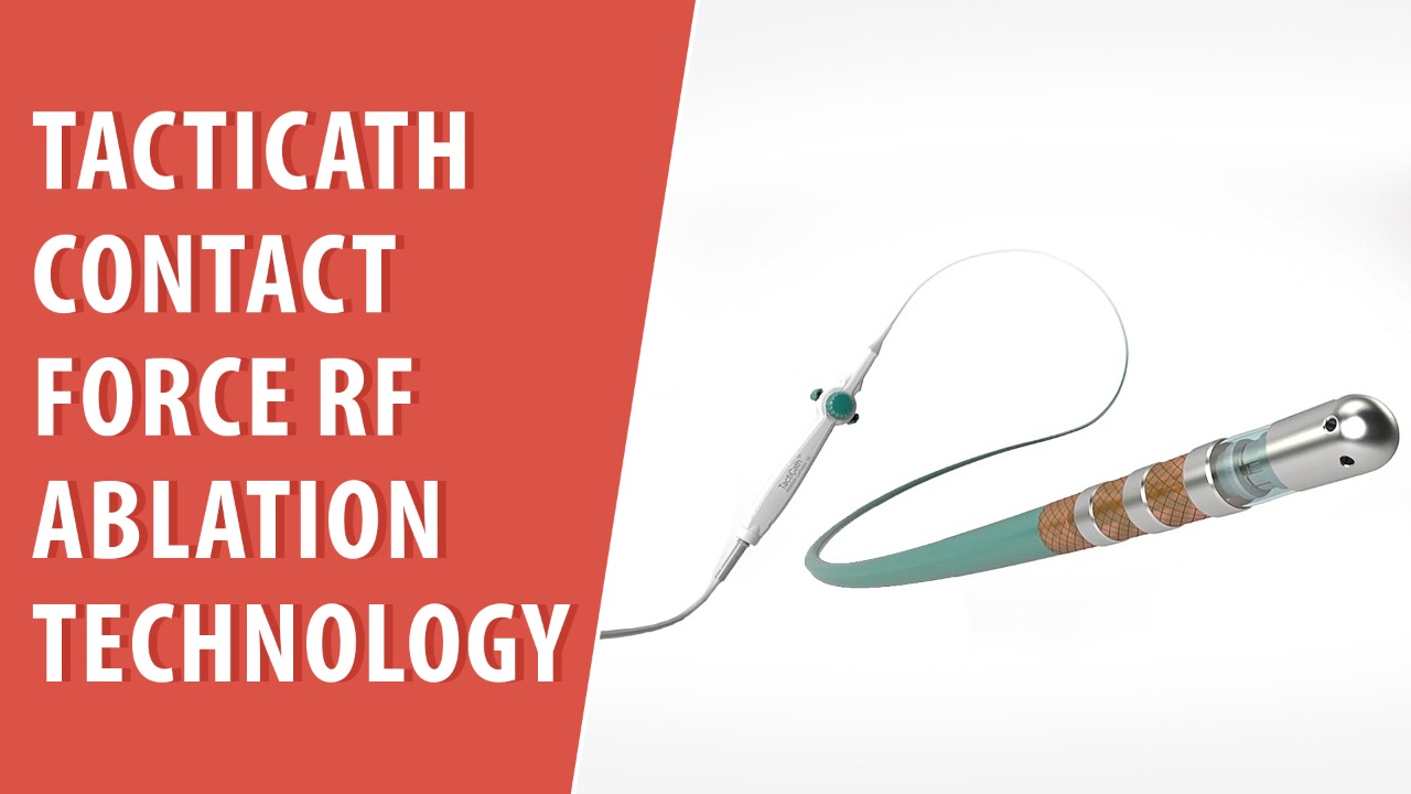 TactiCath Contact Force RF ablation technology