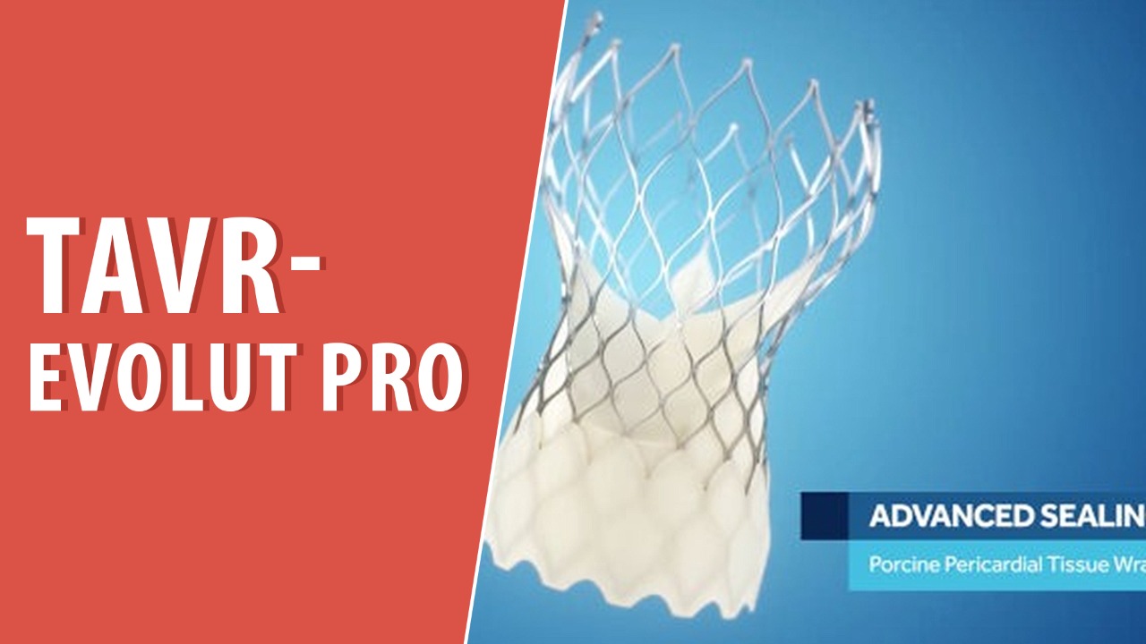 TAVR-Evolut PRO