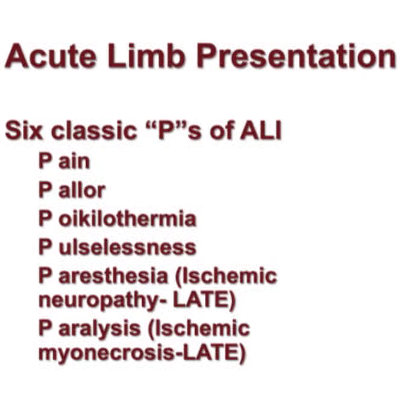 Approach to Acute Limb ischemia | CardioVisual: Heart Health App Built ...