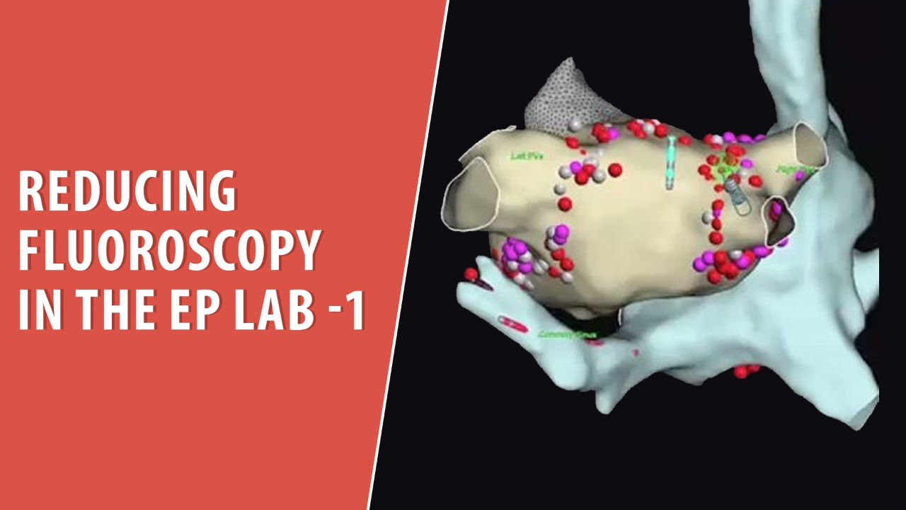 Reducing Fluoroscopy in the EP Lab -1